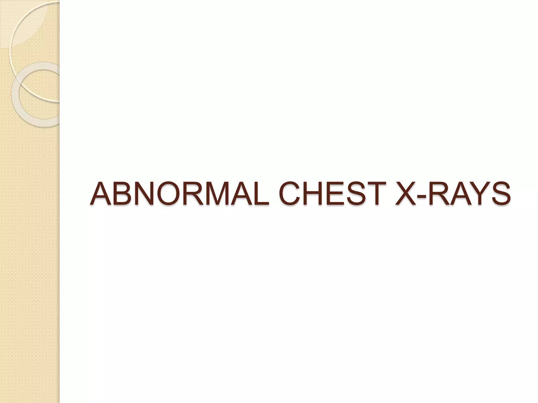 CHEST X-RAY F.pptx