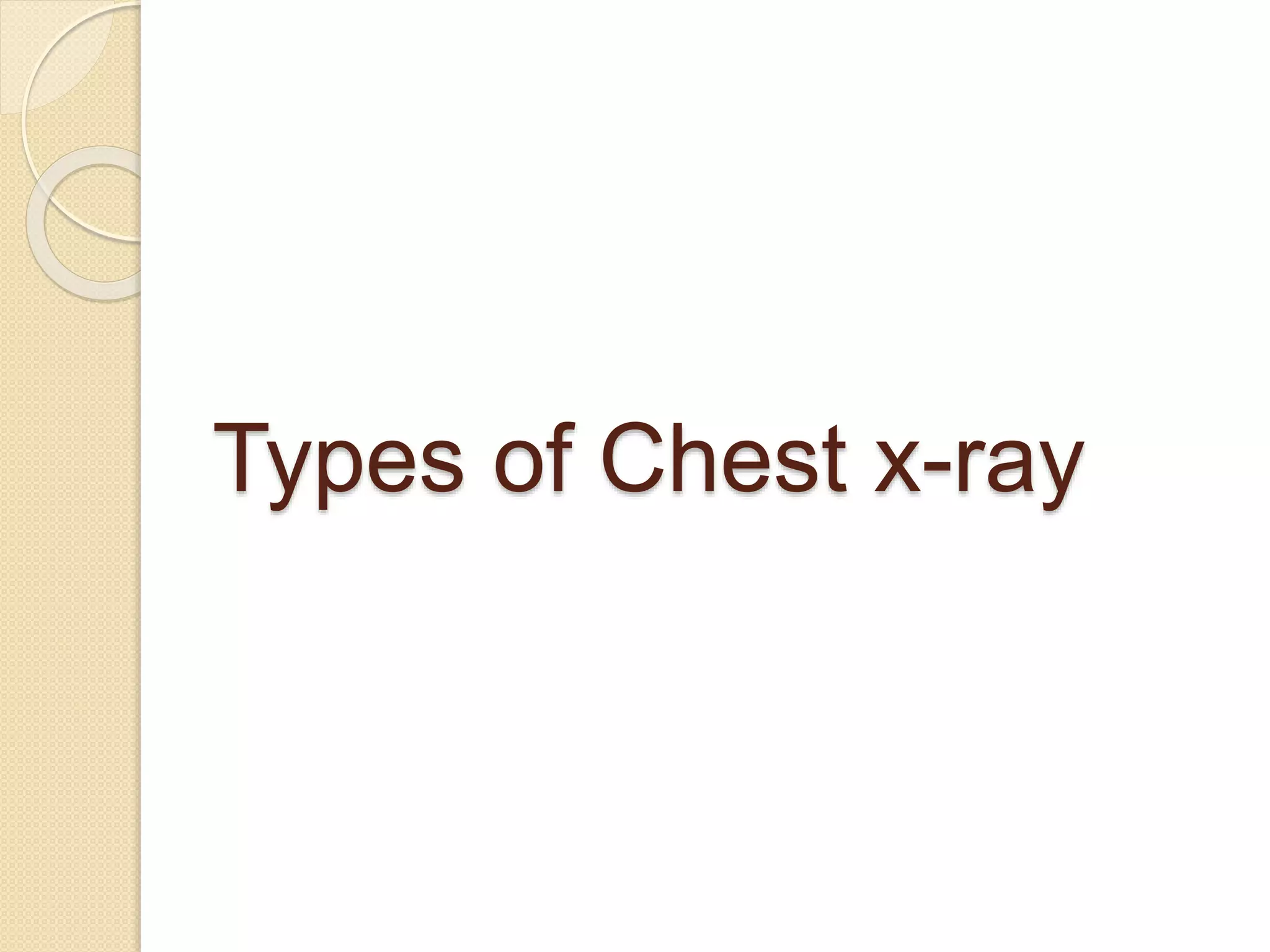 CHEST X-RAY F.pptx