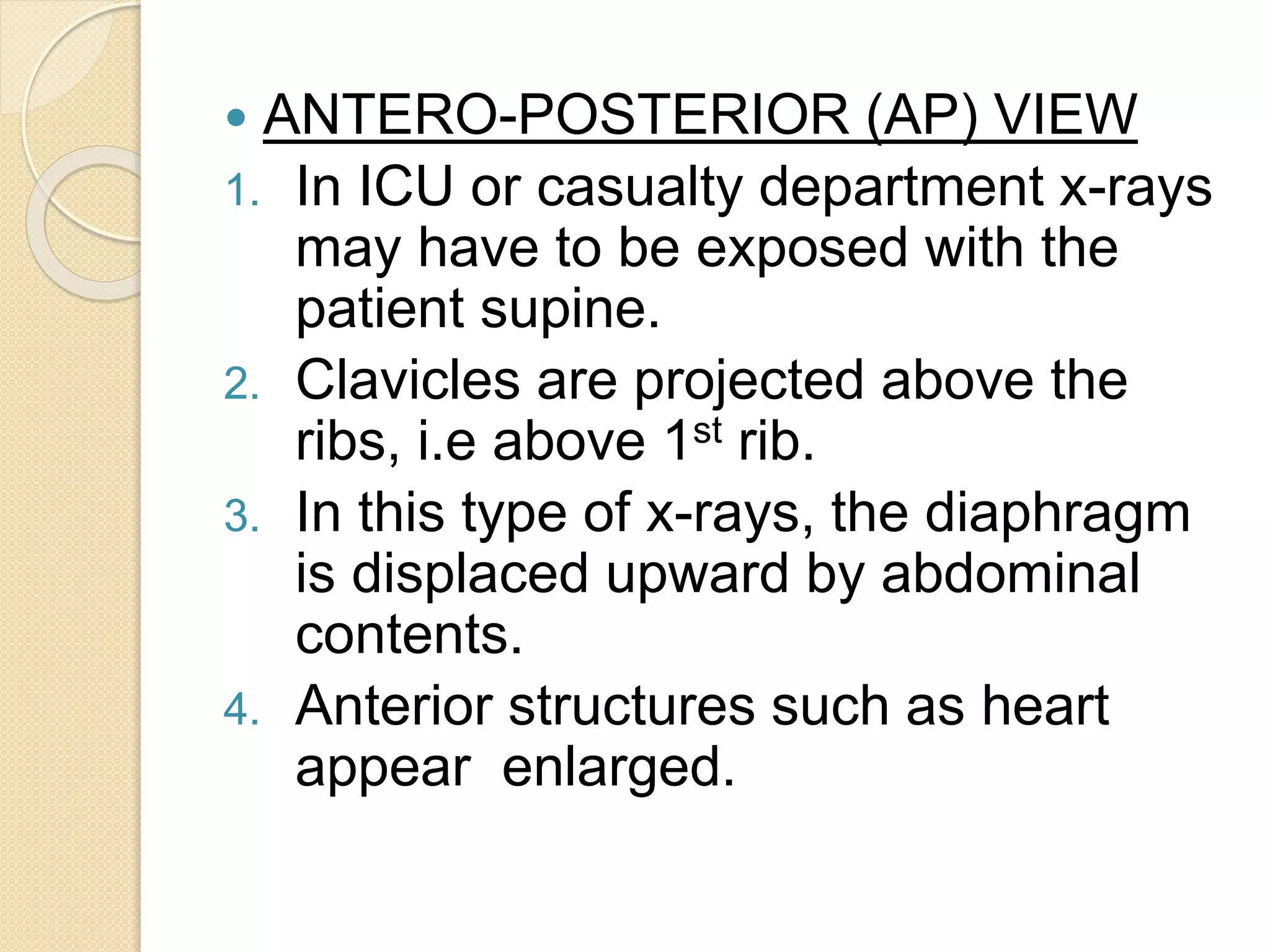 CHEST X-RAY F.pptx