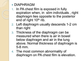 CHEST X-RAY F.pptx
