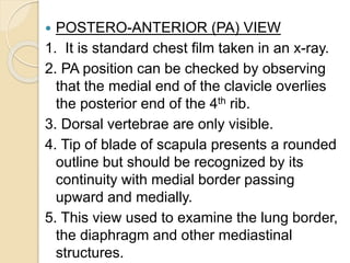 CHEST X-RAY F.pptx