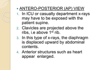 CHEST X-RAY F.pptx
