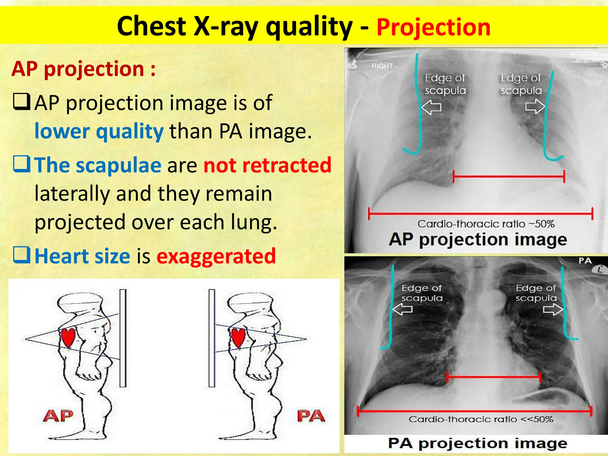 Chest X-ray Fundamentals on Acquisition and Interpretation.pdf