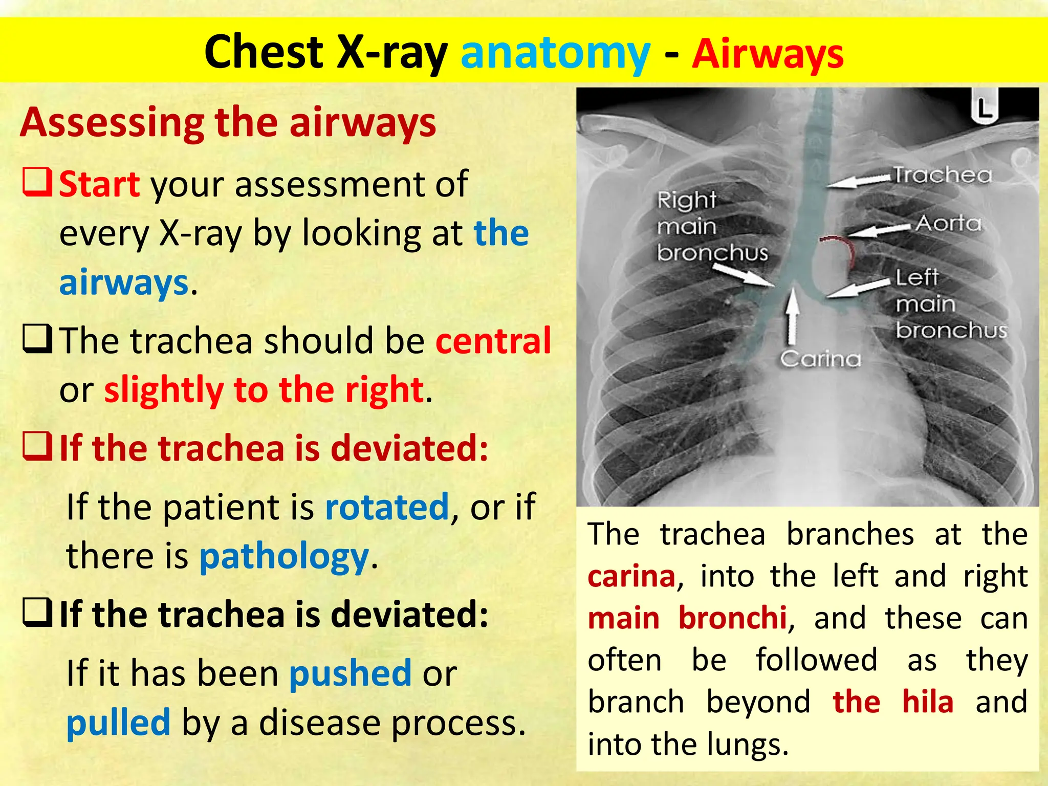 Chest X-ray Fundamentals on Acquisition and Interpretation.pdf