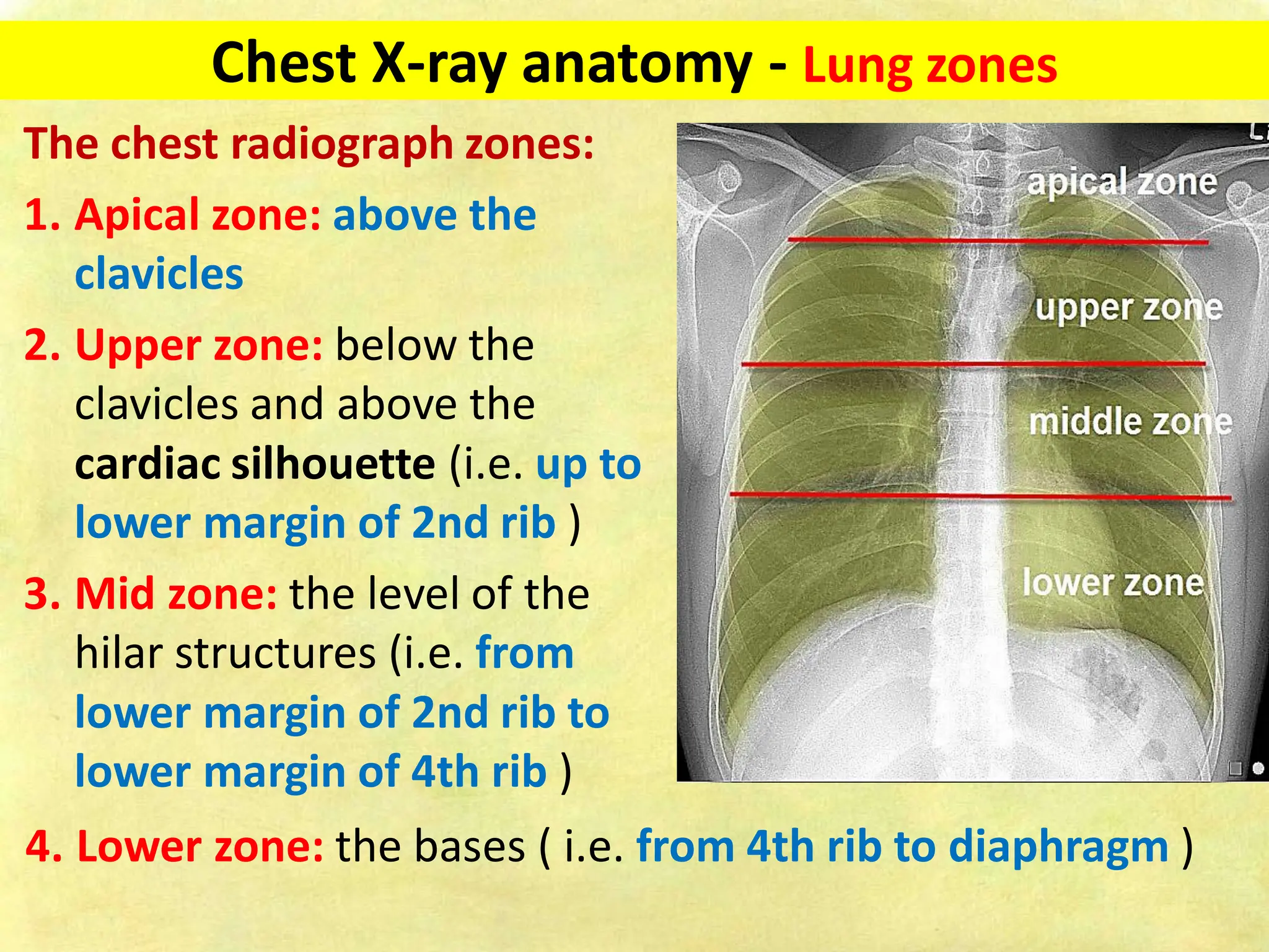 Chest X-ray Fundamentals on Acquisition and Interpretation.pdf