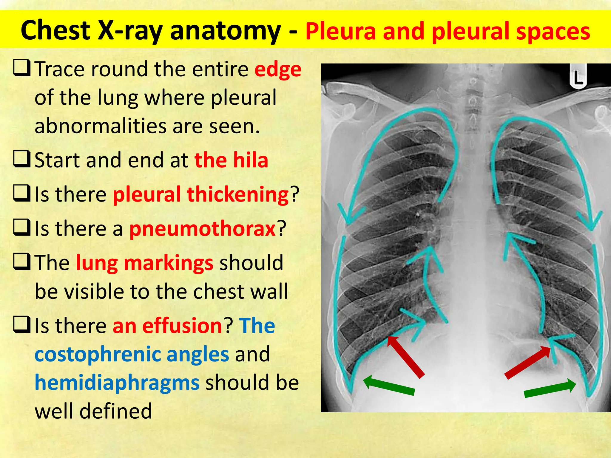 Chest X-ray Fundamentals on Acquisition and Interpretation.pdf
