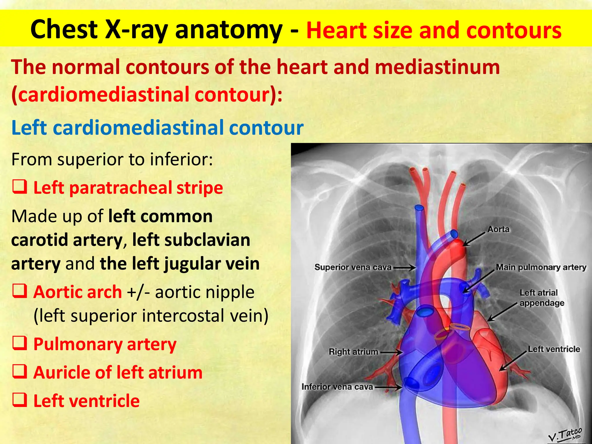 Chest X-ray Fundamentals on Acquisition and Interpretation.pdf