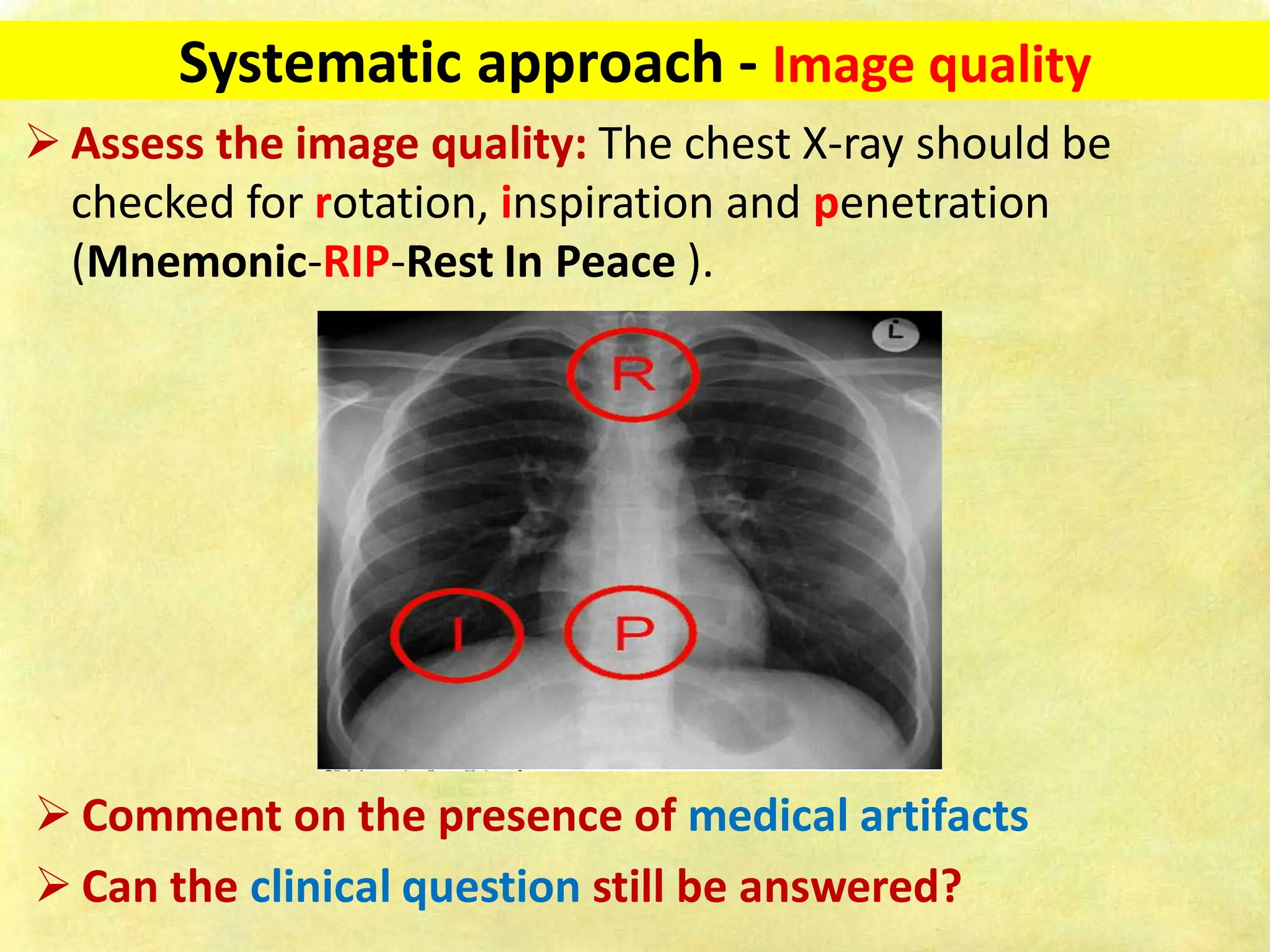 Chest X-ray Fundamentals on Acquisition and Interpretation.pdf