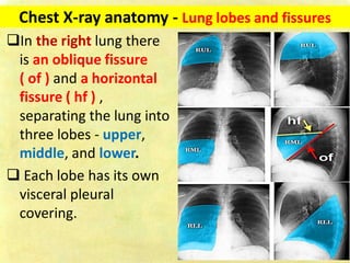Chest X-ray Fundamentals on Acquisition and Interpretation.pdf