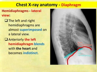 Chest X-ray Fundamentals on Acquisition and Interpretation.pdf