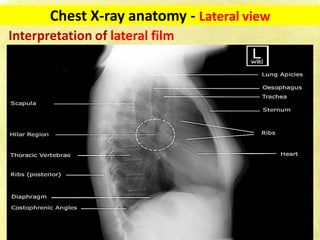 Chest X-ray Fundamentals on Acquisition and Interpretation.pdf