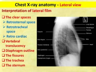Chest X-ray Fundamentals on Acquisition and Interpretation.pdf