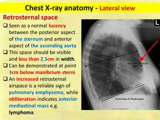 Chest X-ray Fundamentals on Acquisition and Interpretation.pdf