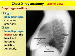 Chest X-ray Fundamentals on Acquisition and Interpretation.pdf