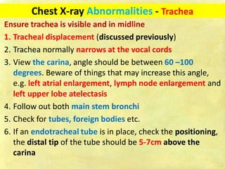 Chest X-ray Fundamentals on Acquisition and Interpretation.pdf