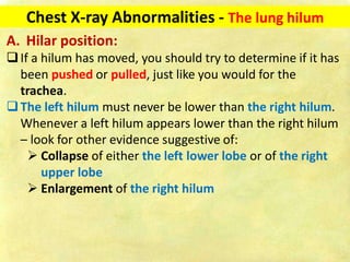 Chest X-ray Fundamentals on Acquisition and Interpretation.pdf