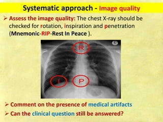 Chest X-ray Fundamentals on Acquisition and Interpretation.pdf