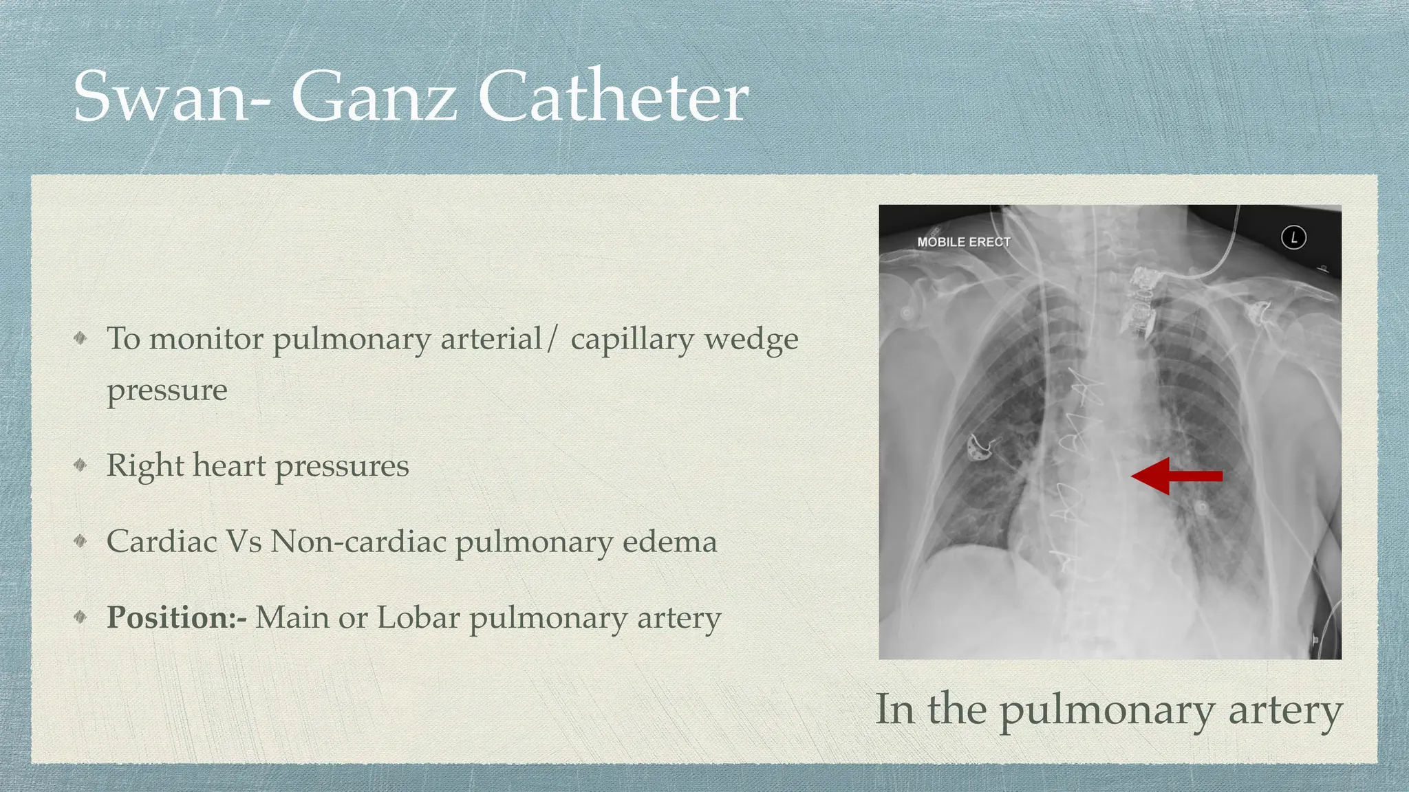 Chest X-ray in ICU setting and common pathologies.pdf