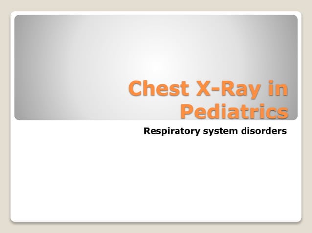 Chest X-Ray in Pediatrics.pptx