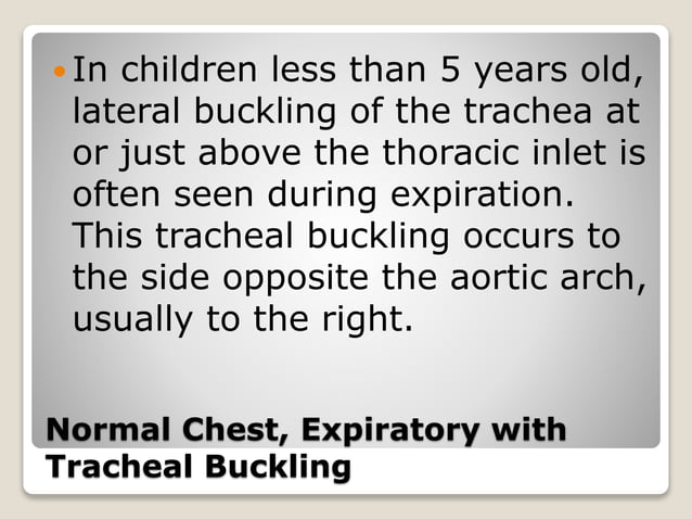 Chest X-Ray in Pediatrics.pptx