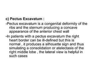 Chest X-rays Basic Interpretation | PPT
