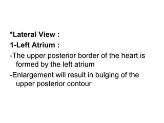 Chest X-rays Basic Interpretation | PPT