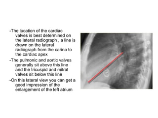 Chest X-rays Basic Interpretation | PPT