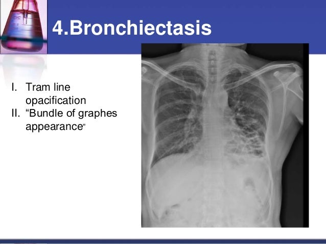Chest x ray interpretation