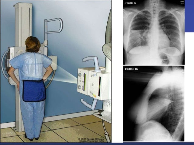 Chest x ray interpretation