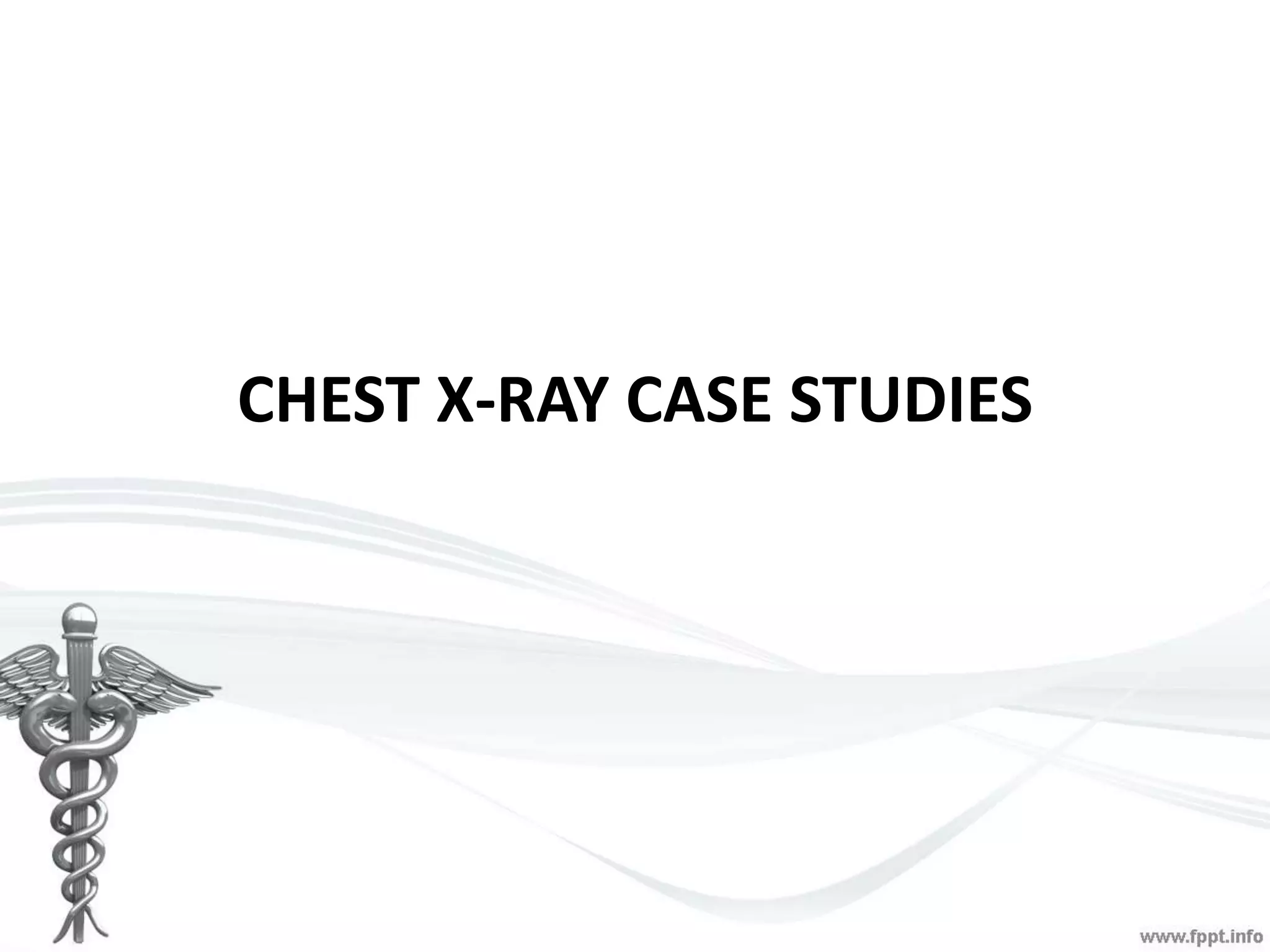 Easy guide to Chest x-ray Interpretation & Case Studies | PPTX