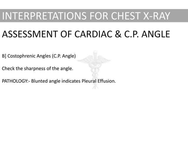 Easy guide to Chest x-ray Interpretation & Case Studies | PPTX