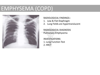 Easy guide to Chest x-ray Interpretation & Case Studies | PPTX