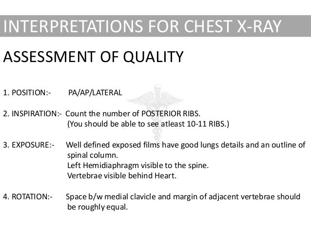 Easy guide to Chest x-ray Interpretation & Case Studies