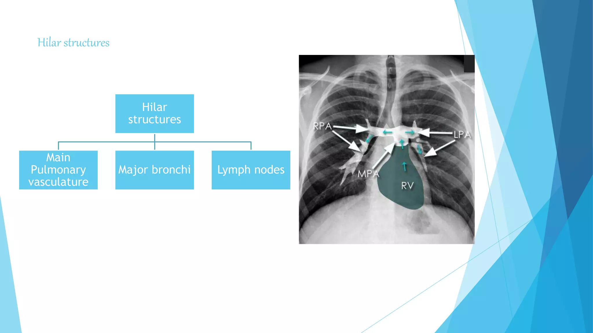 Paediatric Chest X-ray Interpretation | PPTX