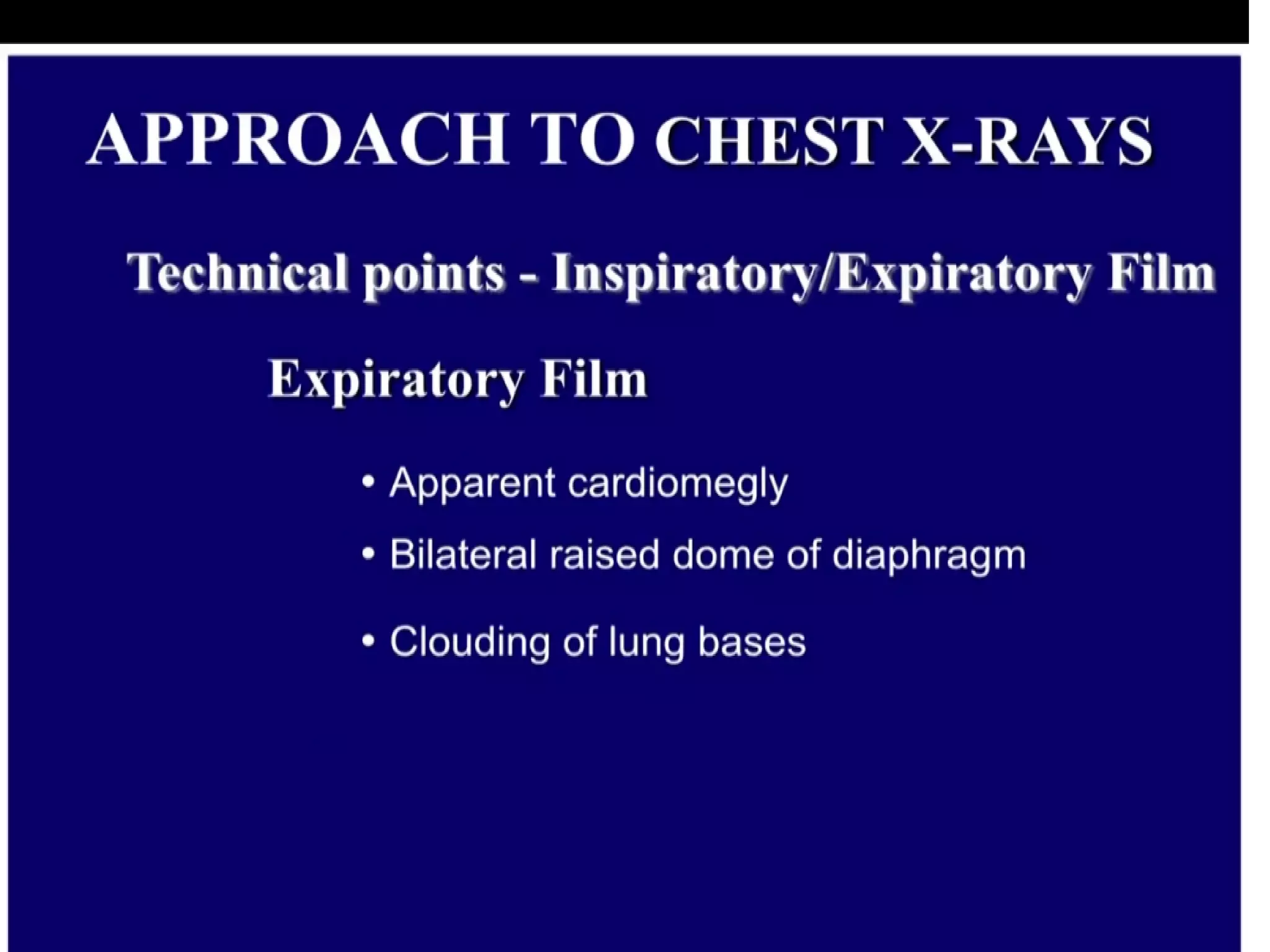 Chest x-ray interpretation.pdf