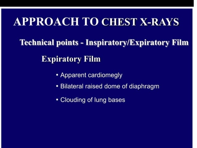 Chest x-ray interpretation.pdf