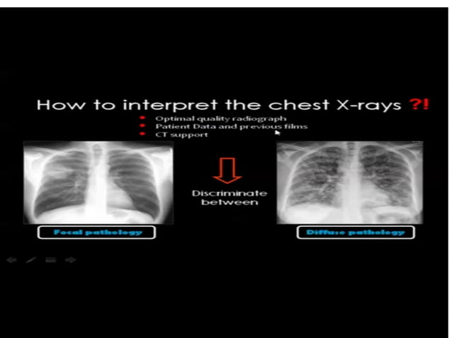 Chest x-ray interpretation.pdf