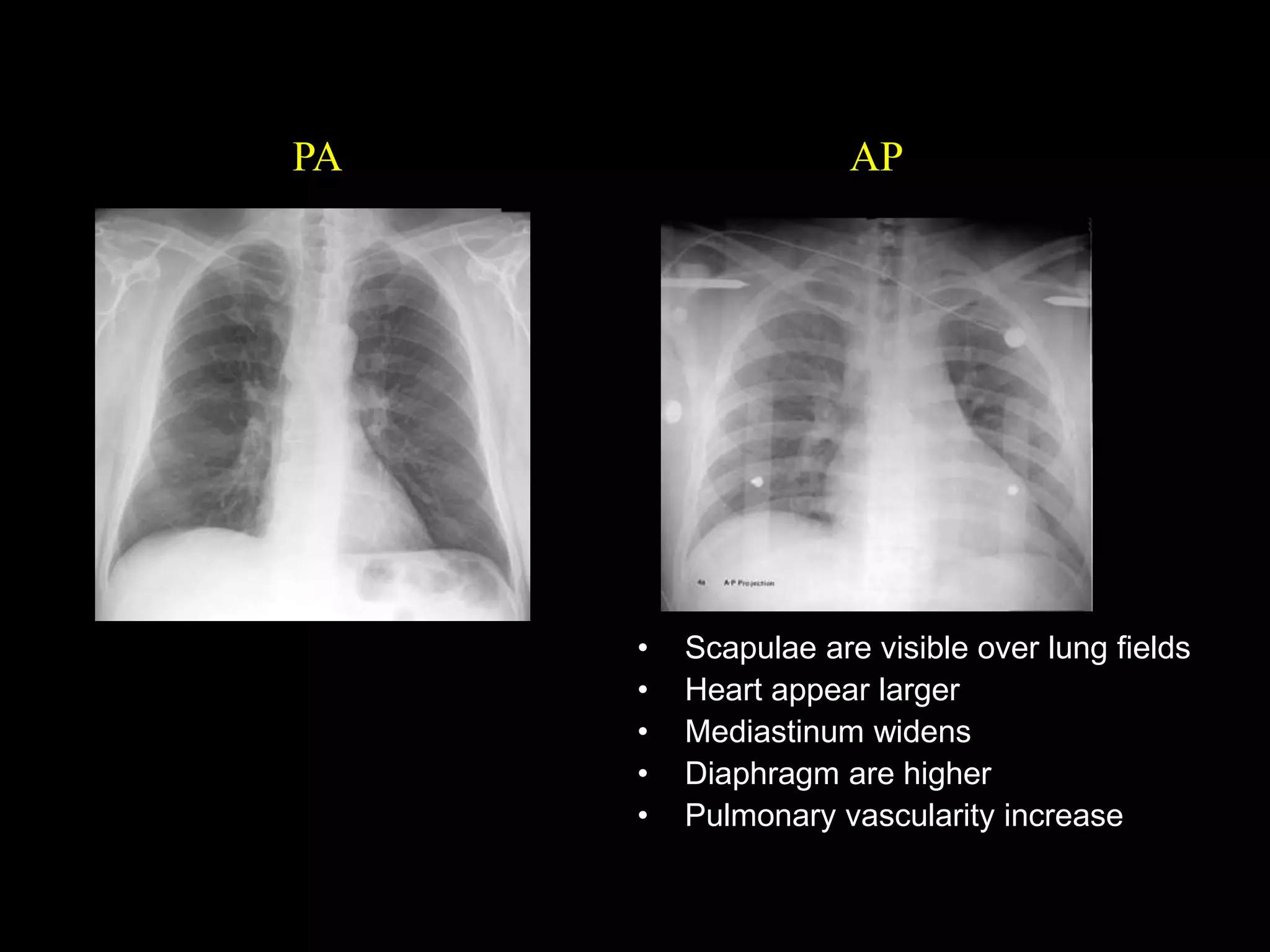 Chest X-ray Interpretation.pptx