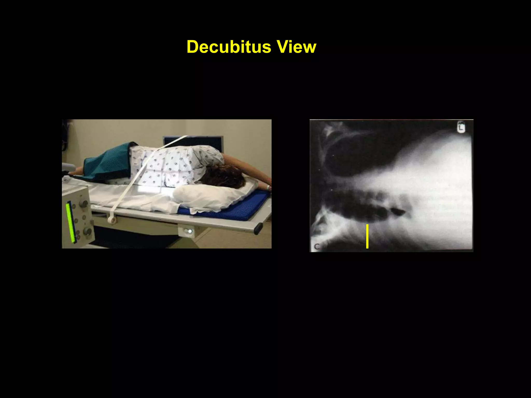 Chest X-ray Interpretation.pptx