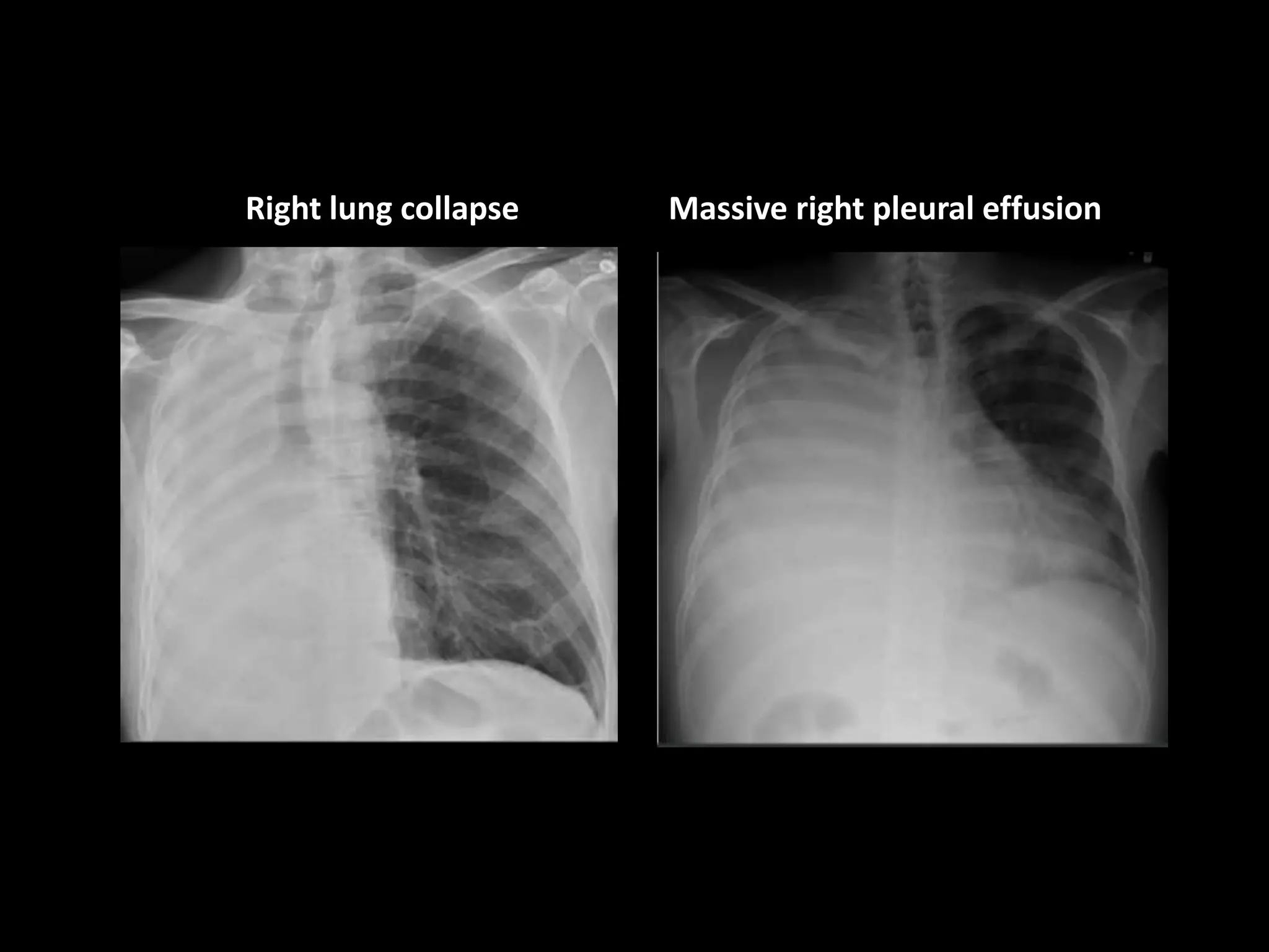 Chest X-ray Interpretation.pptx