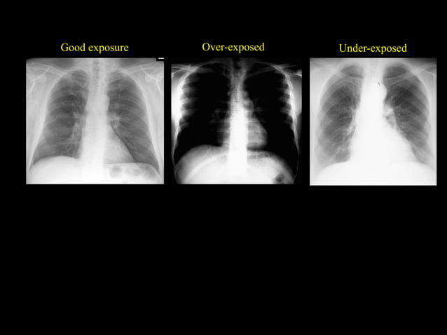 Chest X-ray Interpretation.pptx