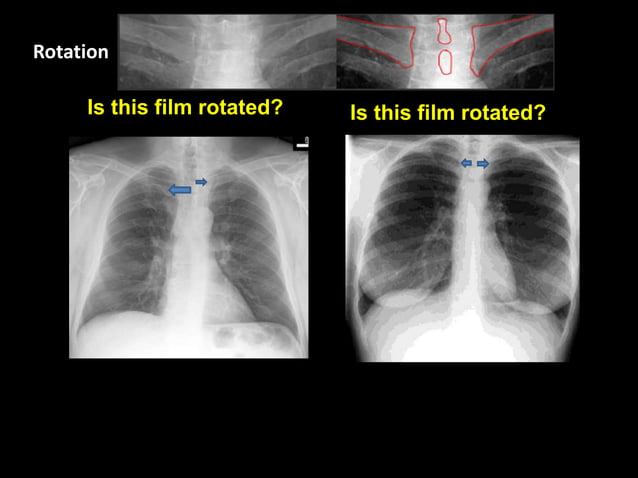 Chest X-ray Interpretation.pptx