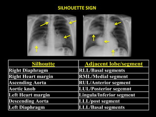 Chest X-ray Interpretation.pptx
