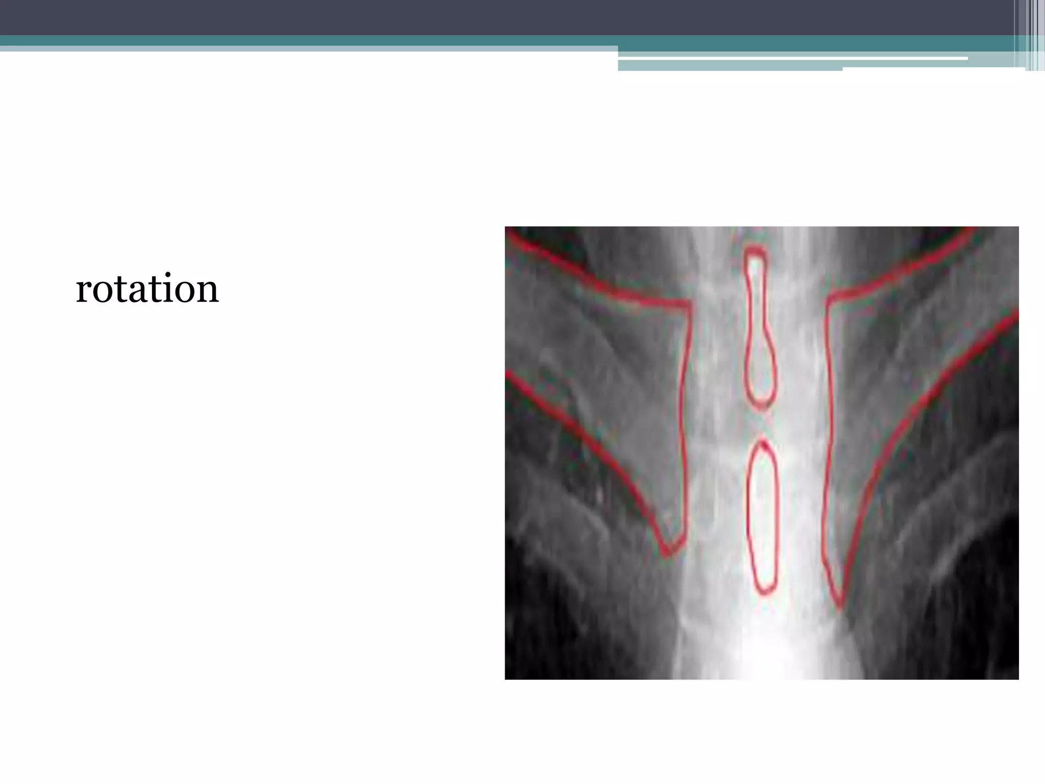 Chest x ray positioning | PPTX