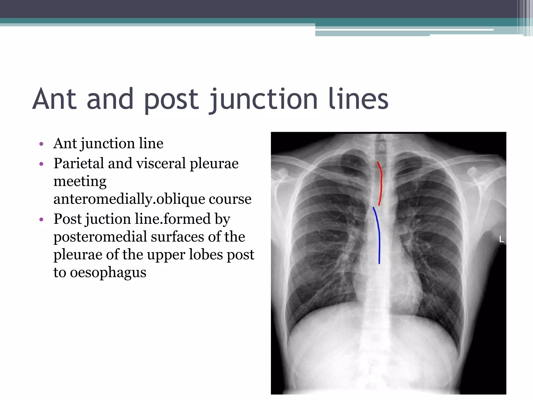 Chest x ray positioning | PPTX