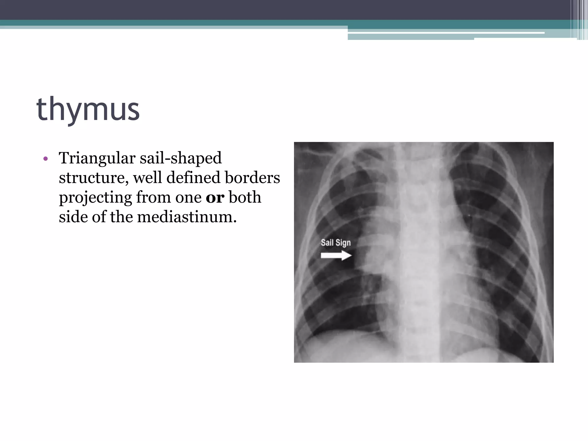 Chest x ray positioning | PPTX