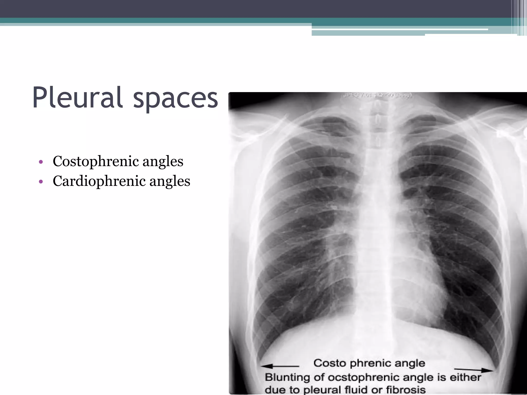 Chest x ray positioning | PPTX
