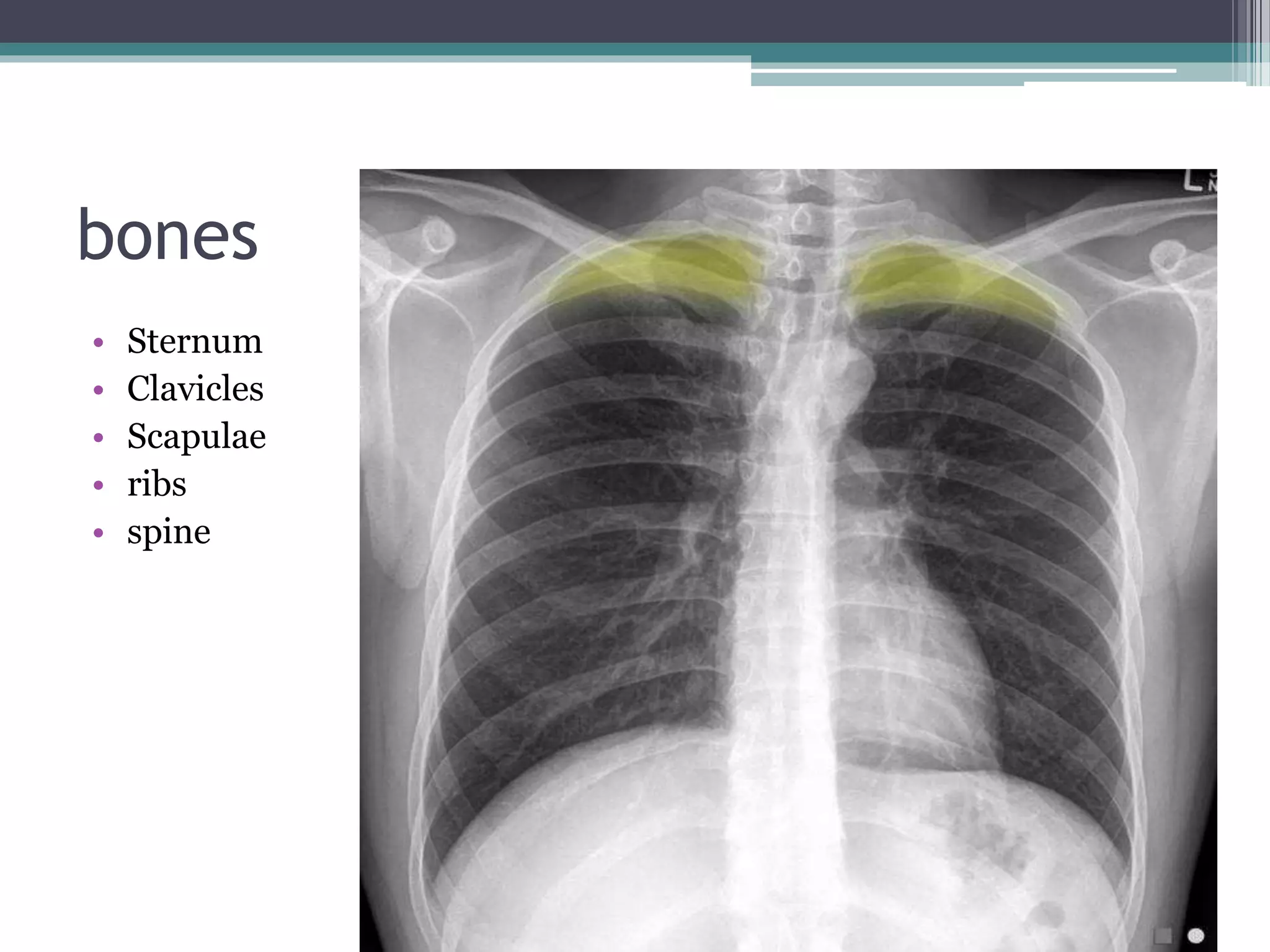 Chest x ray positioning | PPTX