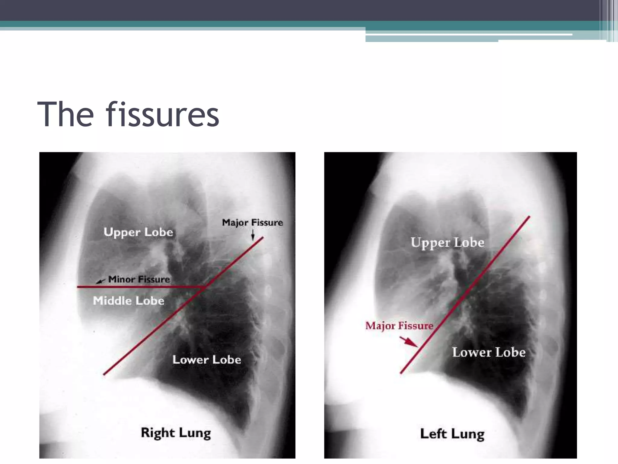 Chest x ray positioning | PPTX