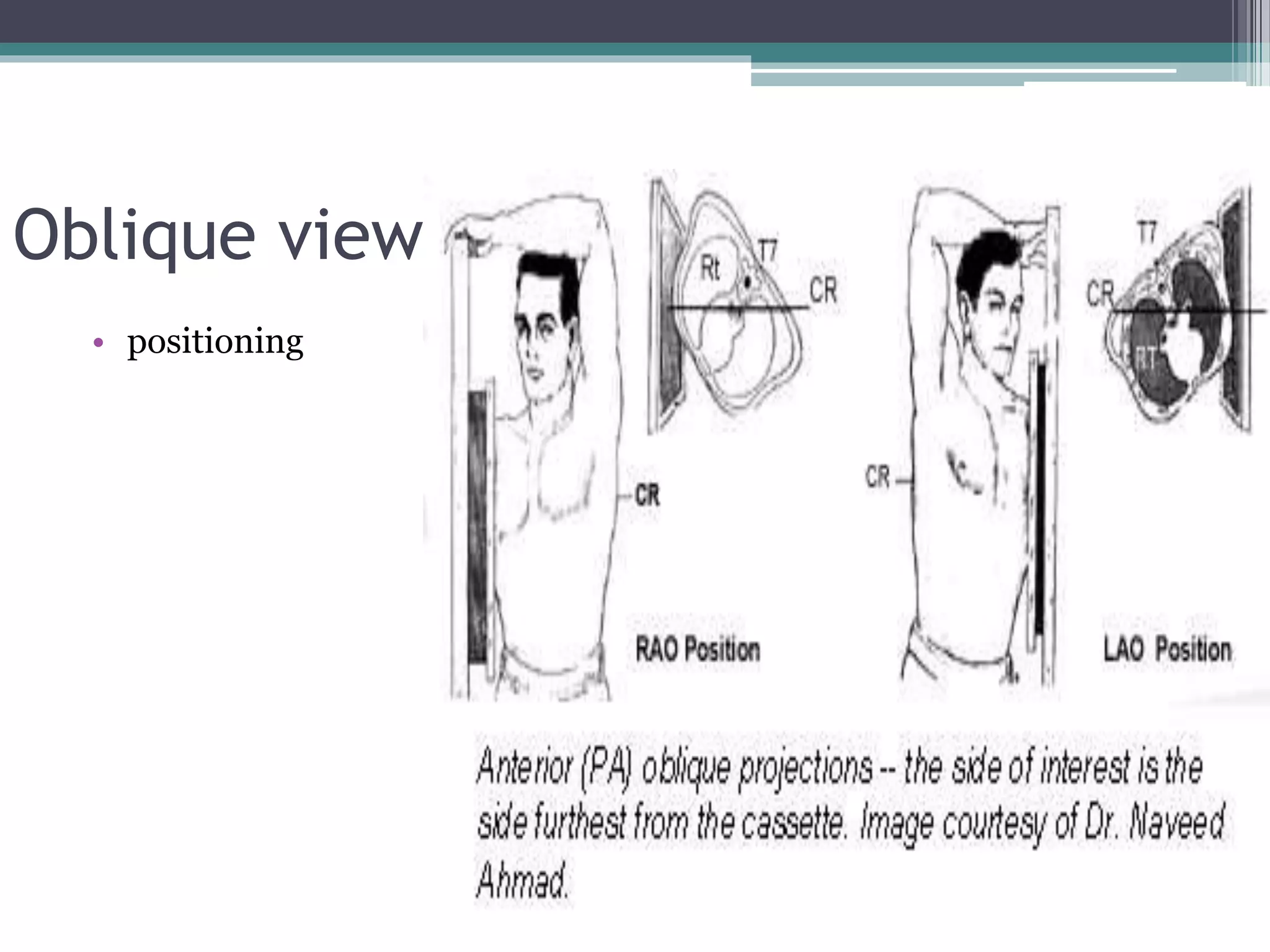 Chest x ray positioning | PPTX